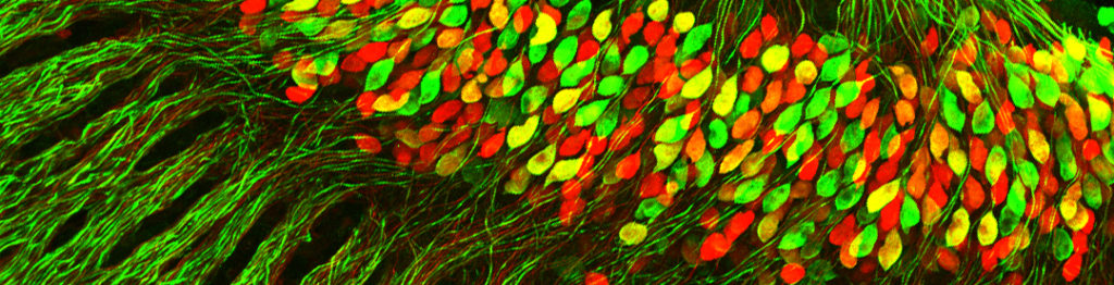 Support Brain Research - Harvard Brain Science Initiative