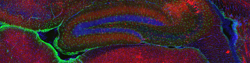 Mailing List - Harvard Brain Science Initiative