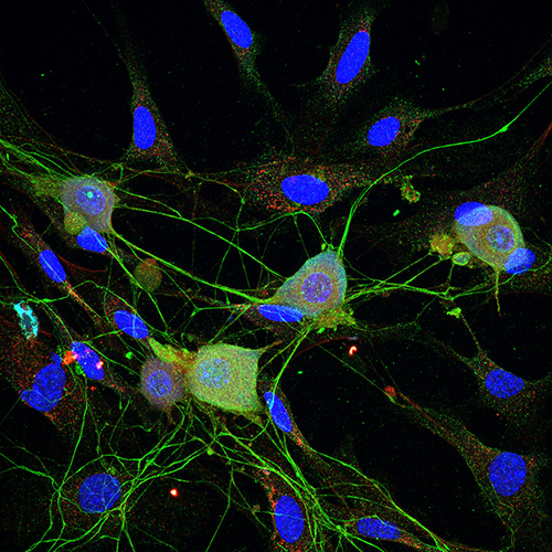 Home - Harvard Brain Science Initiative Home - Harvard Brain Science Initiative