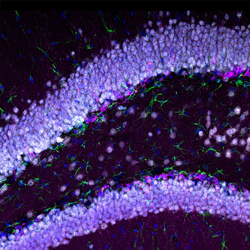 Home - Harvard Brain Science Initiative Home - Harvard Brain Science Initiative